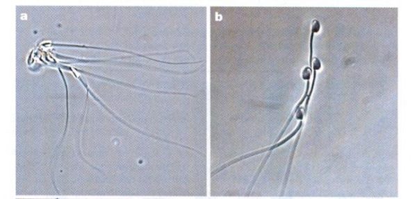 The serpent (worm) is the enlightened creator in the form of the sperm ...